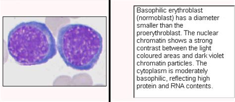 Polychromatophilic Erythroblast