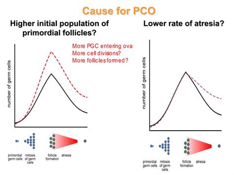 Diagnosis Of Polycystic Ovary Syndrome Ppt