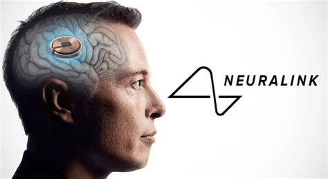 脑机接口公司neuralink开始招募人体临床试验患者 字节点击