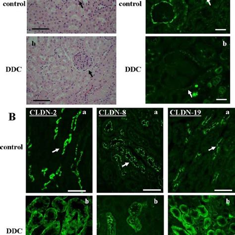 A He Staining In The Livers Of Mice Fed The Ddc Diet For 12 Weeks