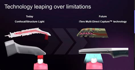 Itero Lumina Released All Details About This New Intraoral Scanner