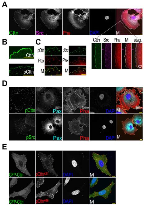 Colocalization Of Tyrosine Phosphorylated Cortactin And Active Src At