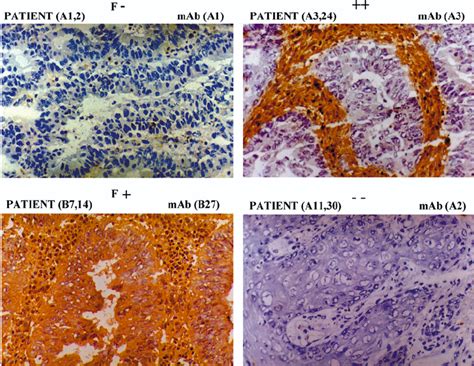 Screening With Anti Hla Allelic Mab On Cryostat Sections The Upper