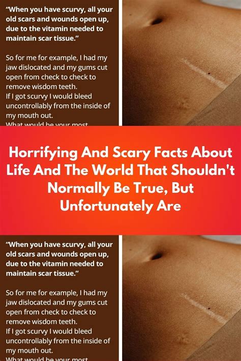 Horrifying And Scary Facts About Life And The World That Shouldn T