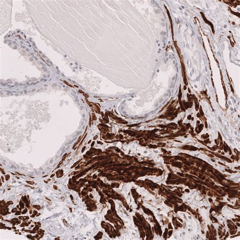 Mouse Monoclonal Anti Myh11 Antibody Buy For Research Highly