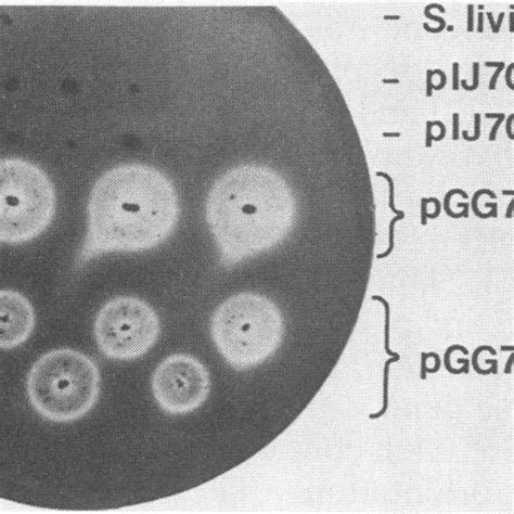 Detection Of Cellulase Positive Transformants In S Lividans By