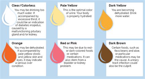 Urine Color Chart Infection Urology Infographic What Your Urines Color Means Scaled Mcesda