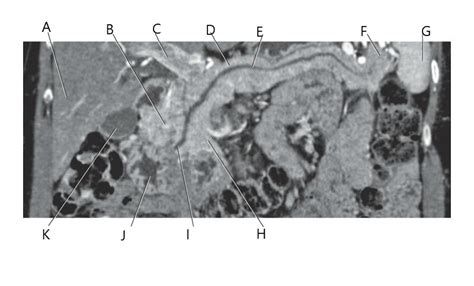Week 9 Assignment 7 Pancreas Q6 Diagram Quizlet