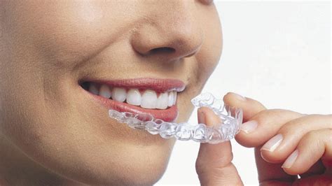 Invisible Clear Braces Hill Street Clinic