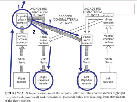 Acoustic Reflex Pathway