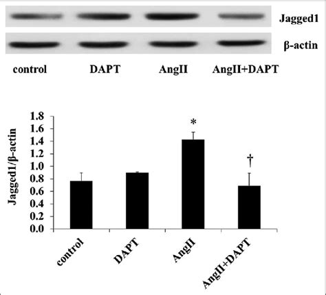 Jagged1 Protein Expression In Lv Tissue N 10 Total Protein From Lv