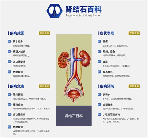 肾结石百科知识详解 四川结石病专科医院