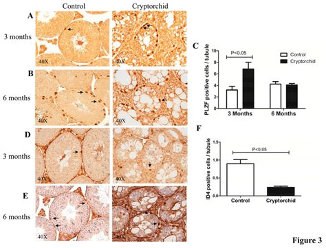 Immunohistochemistry Ihc Analysis For Plzf And Id4 Staining In