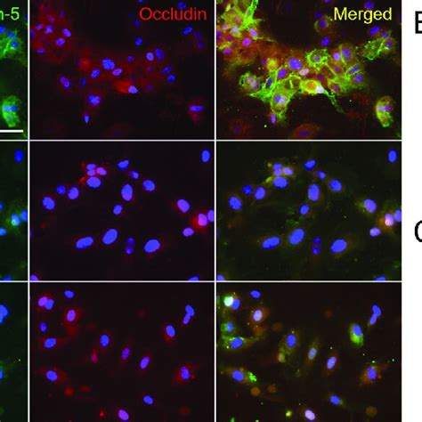 Exogenous Glucuronoxylomannan Gxm Administration And Cryptococcus