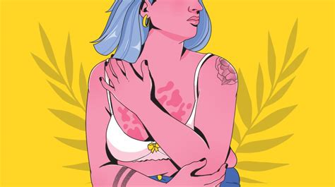 Eczema Flare Up Symptoms 4 Dealing With Dyshidrotic Eczema