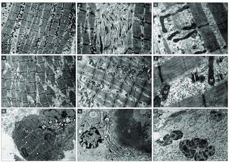 Representative Electron Micrographs Of Longitudinally Sectioned