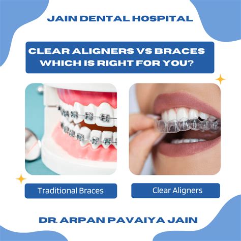 Clear Aligners Vs Braces Which Is Right For You Jain Dental Hospital