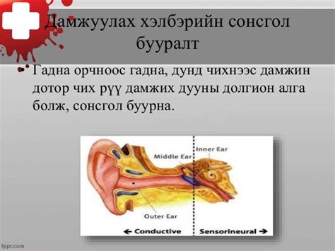 Дотор чихний эмгэг