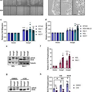 Vangl1 And Vangl2 Overexpression Promote Breast Cancer Cell Migration