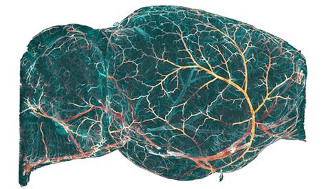 The First Complete Mapping Of Cerebral Vasculature Paris Brain Institute