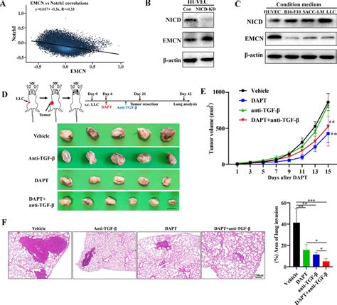 Notch Inhibition Upregulated Emcn Expression In Huvecs And Combination