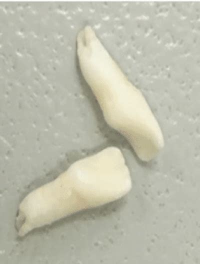 Identifying Hpp
