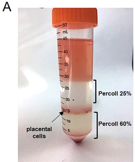 Isolation Of Placental Cells By Percoll Cushion Representative Image Download Scientific
