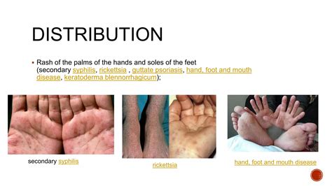 Approach To Skin Rash Pptx