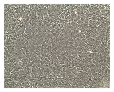 The Morphology Of Inductions Of Adipose Derived Stem Cell I Adsc