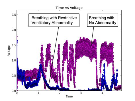 Diagnosis Of Restrictive Ventilatory Abnormality Download Scientific