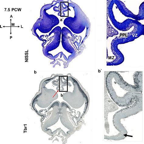 Development Of The Medial Interhemispheric Cortex Revealed By Nissl