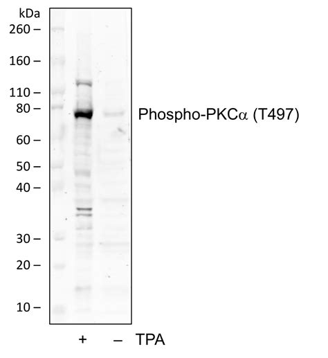 Phospho Pkca T497 Recombinant Mab Abwiz Bio