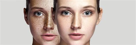 Pico Genesis Revive At The Group Med Spa Pico Genesis Revive At The Group Med Spa