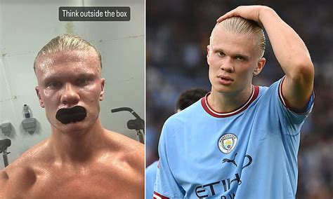 Erling Haaland Shares Topless Picture While Wearing Breathing Aid Over