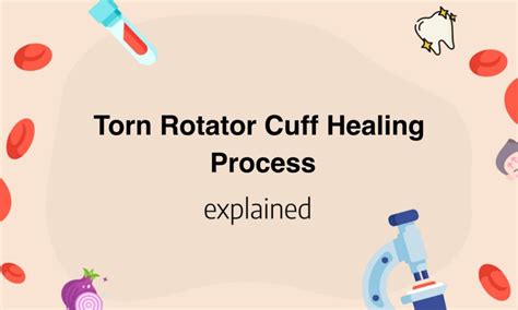 How Long Does It Take For A Torn Rotator Cuff To Heal Without Surgery