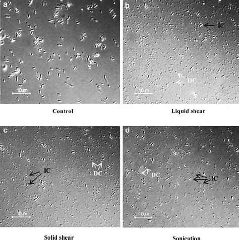 Differential Interference Contrast Micrographs Of Disrupted Cells Of A