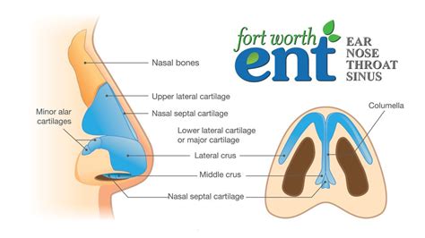 Vivaer® Nasal Airway Remodeling Fort Worth Ent And Sinus