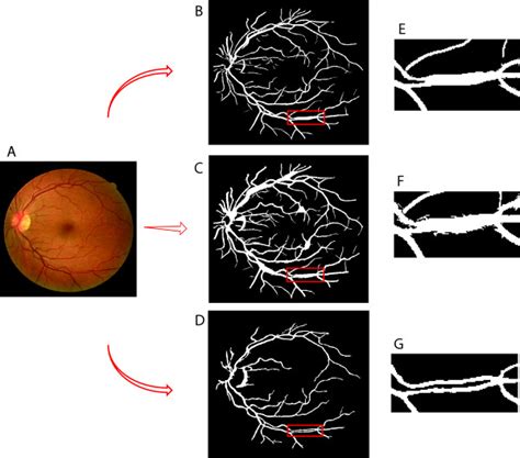 Our Segmenter Based On Existing Methods A Original Color Fundus Download Scientific Diagram