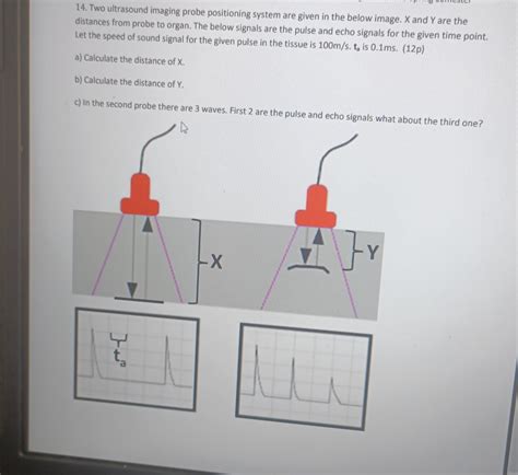 Solved 14 Two Ultrasound Imaging Probe Positioning System