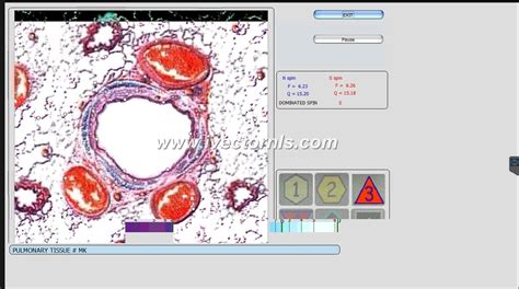 How To Use Vector Expert Nls The Right Way