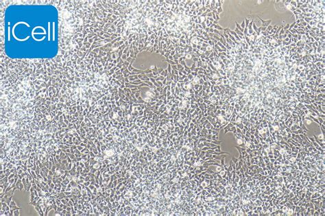 Sk N Mc 人神经上皮瘤细胞 原代细胞 Str细胞 细胞培养基 镜像绮点生物