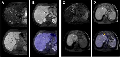 Pet Scan Cpt Code Naf Pet Scans Or Bone Pets Are Considered Investigational By Cms