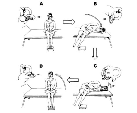 6 Pics Barbecue Roll Horizontal Bppv And Description Alqu Blog