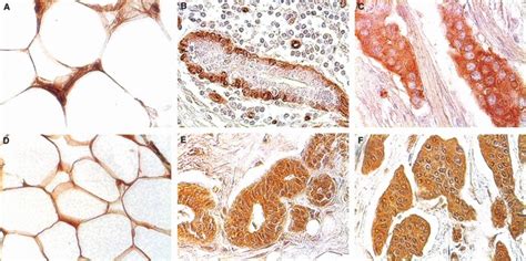 Immunohistochemical Detection Of Adiponectin Ac And Leptin Df In