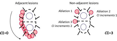 Determination Of Continuity Index Values In Atrial Fibrillation Ablation With Proactive