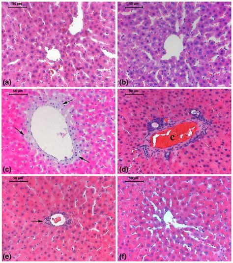 Hande Stained Liver Sections Of Different Groups Normal Histological