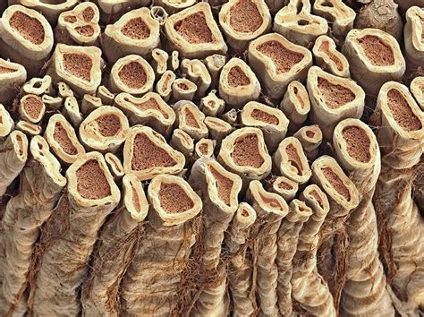 Spinal Root Nerves Sem Stock Image C0065940 Science Photo Library