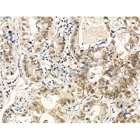 Phospho Tdp43 Ser409ser410 Antibody Affinity Biosciences Ltd亲科生物官网