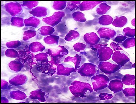 Lymph Node Cytology Morphology And Beyond Intechopen