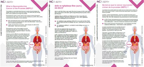 New Factsheet Covering Neuroendocrine Cancer Of The Prostate Inca